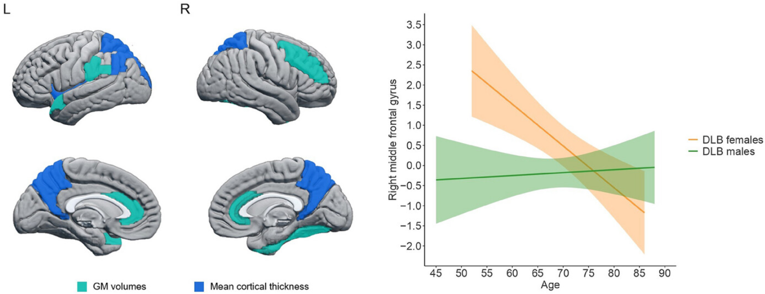 Sex Differences In Brain Atrophy In Dementia With Lewy Bodies Pdbp